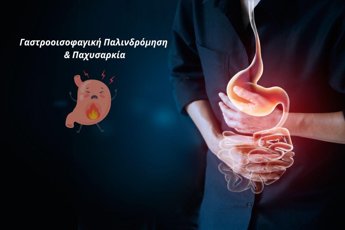 Γαστροοισοφαγική παλινδρόμηση και παχυσαρκία: Κίνδυνοι & αντιμετώπιση